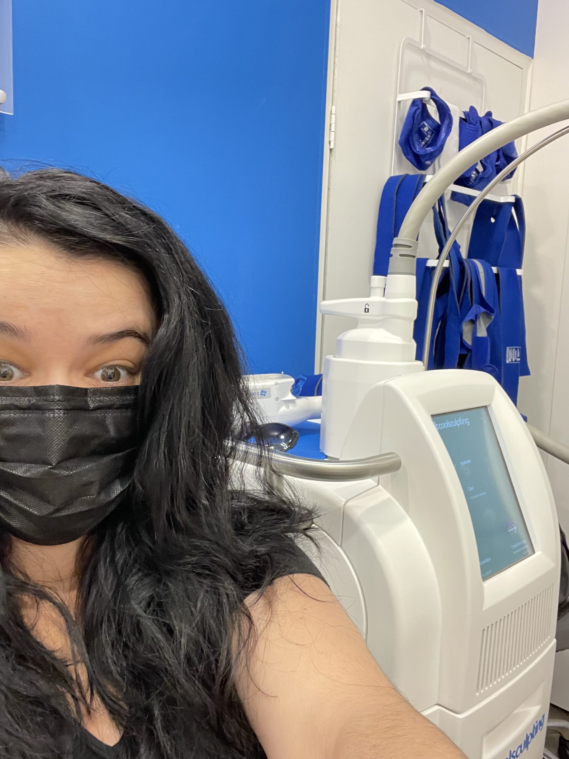 CoolSculpting Review: Does It Work? | Embrace Brisbane